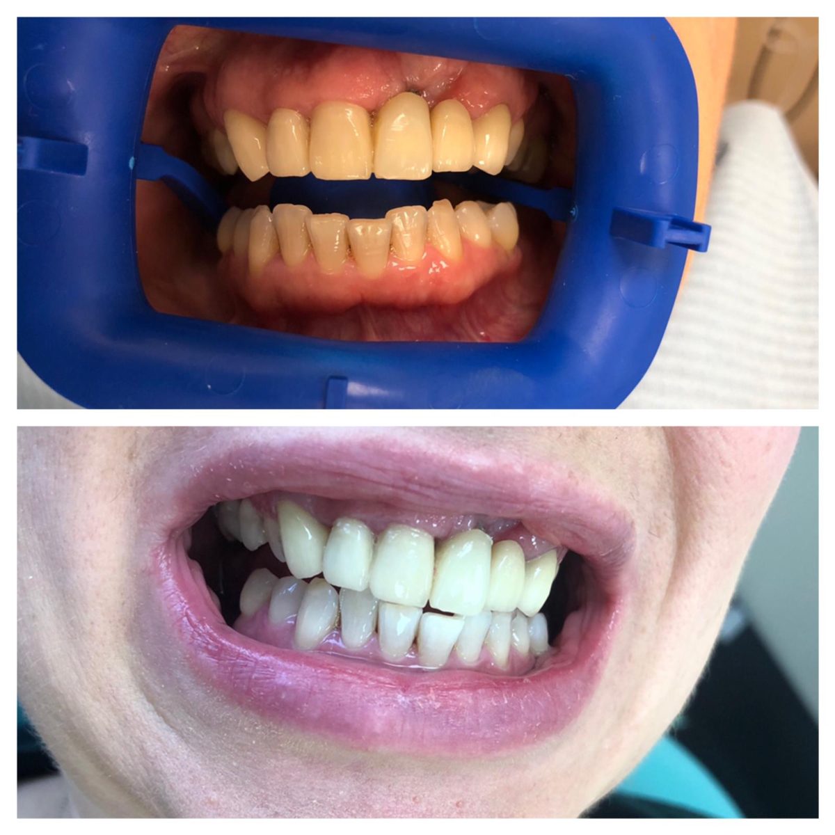 Gallery | Queensway Dental Practice